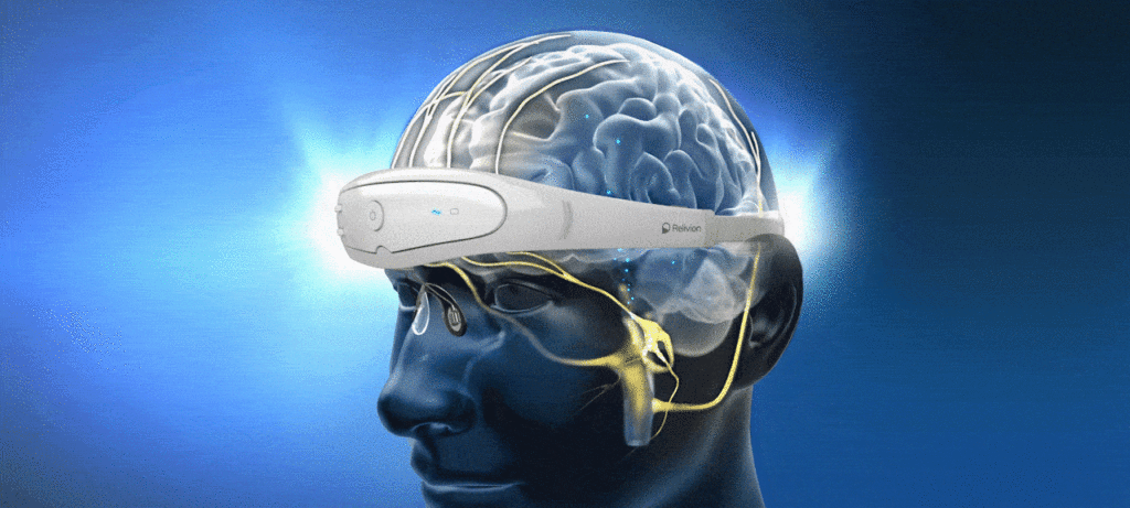 A Patient's Guide to Neuromodulation